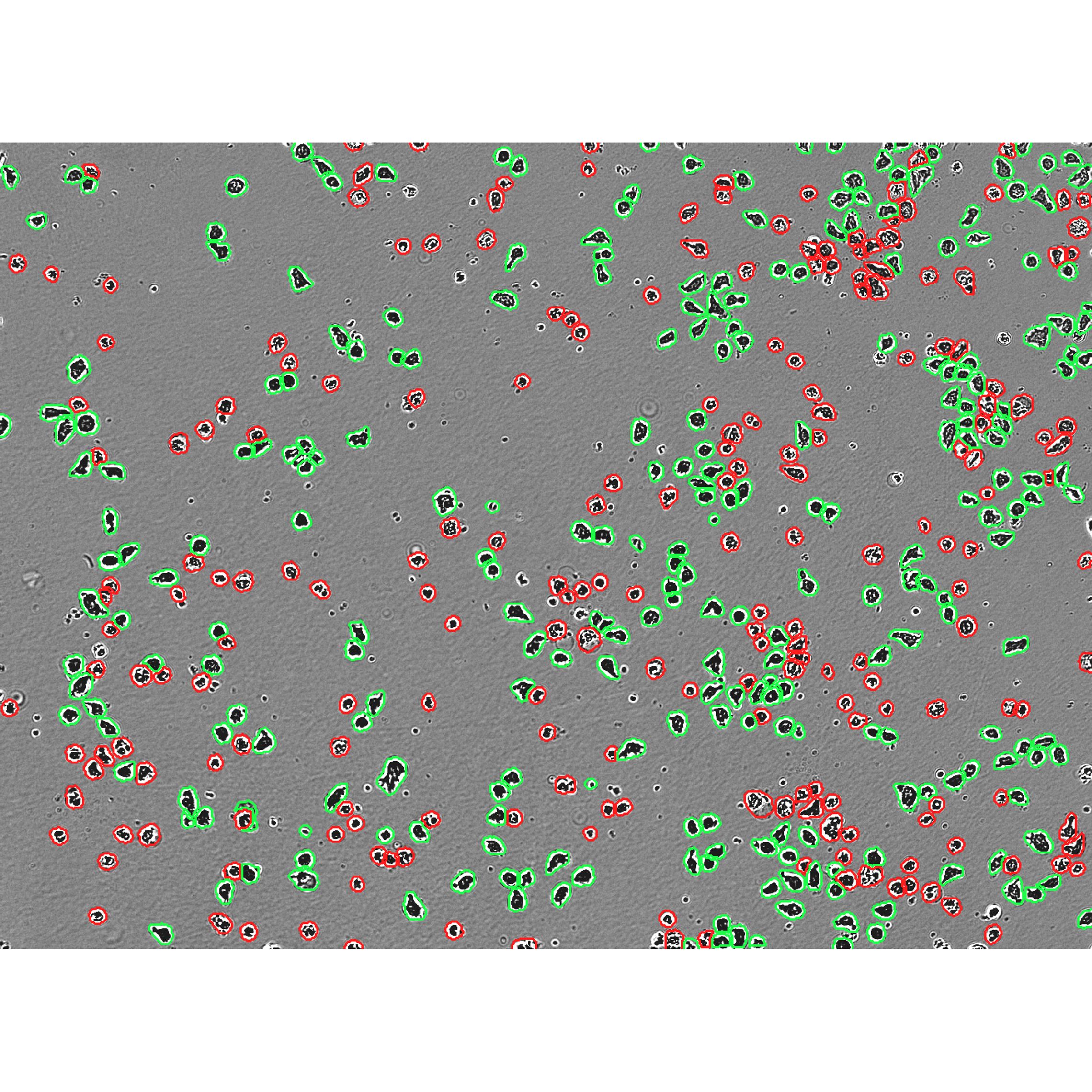 Incucyte® AI 细胞健康状态分析软件模块 | 德国赛多利斯 Sartorius