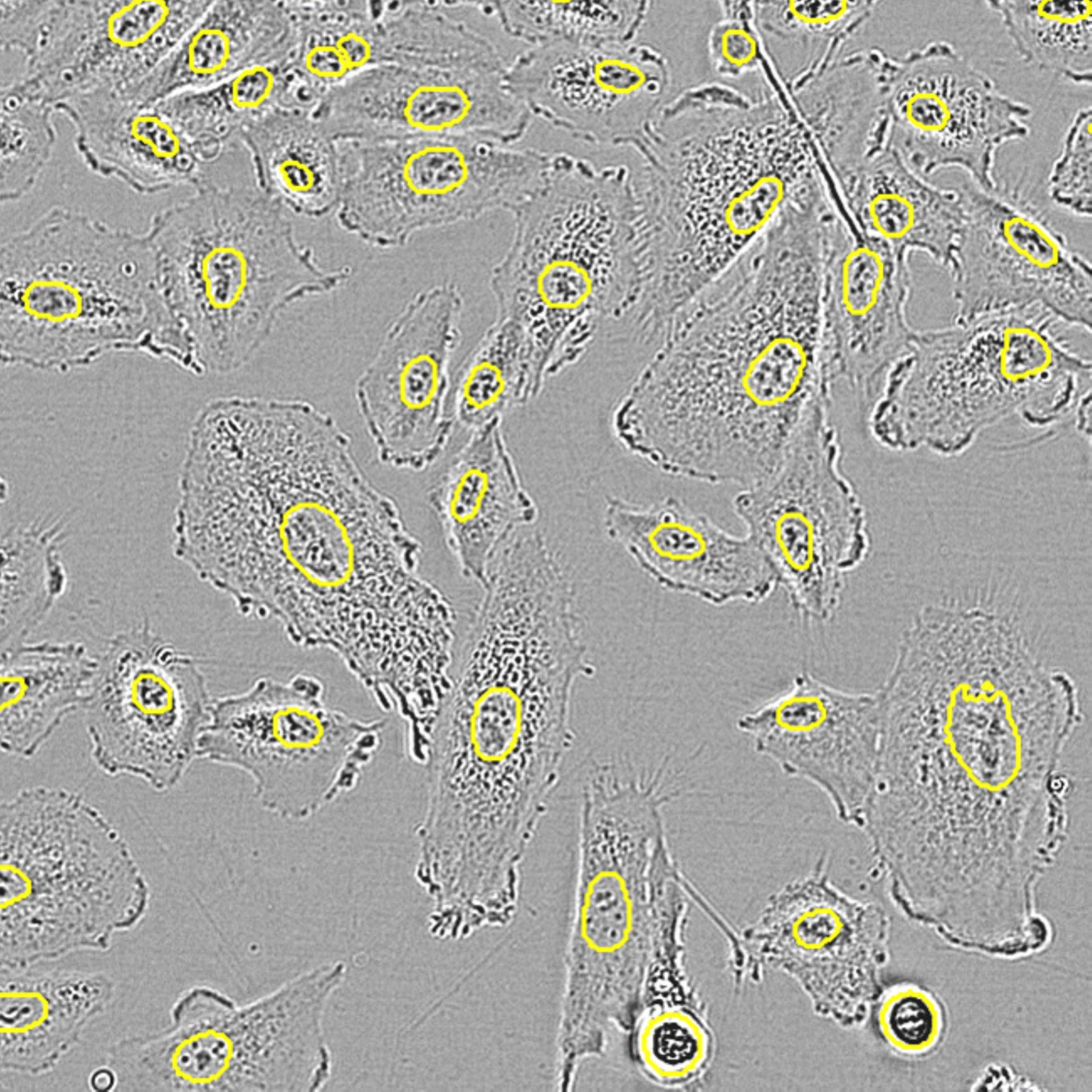 Incucyte® AI 细胞核分析软件模块 | 德国赛多利斯 Sartorius